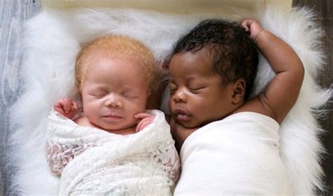 Photographer Gives Birth To Twins One Black And One White But Wait