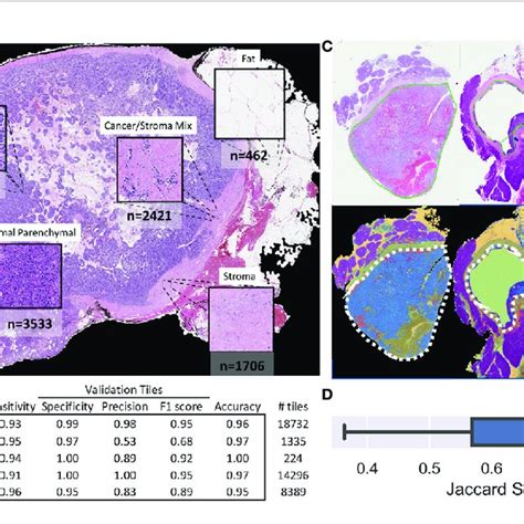 Tile And Whole Slide Performance Of The Cnn Based Tissue Annotation