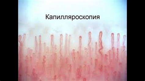 Капилляроскопия обучение от доктора Голода Youtube