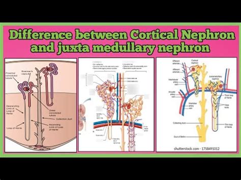 Difference Between Cortical Nephron And Juxta Medullary Nephron