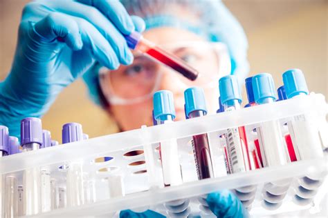 Laboratory Tests MedlinePlus