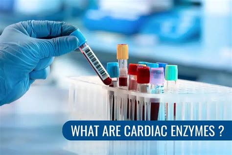 Cardiac Enzyme Test Understanding Its Purpose And Normal Range