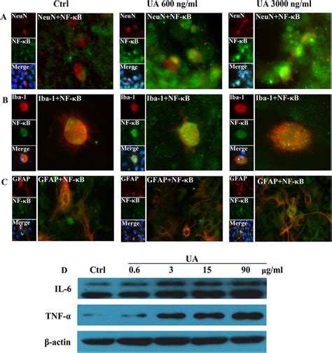 Immunofluorescence analysis of NF κB activation in primary cultured