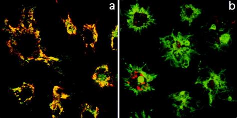 Redistribution Of Mhc Class Ii Molecules During Maturation Download Scientific Diagram