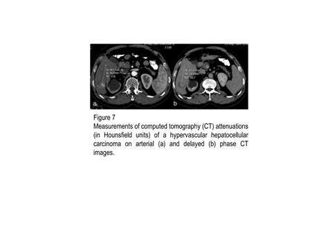 Dynamic Multidetector Computed Tomography Ppt