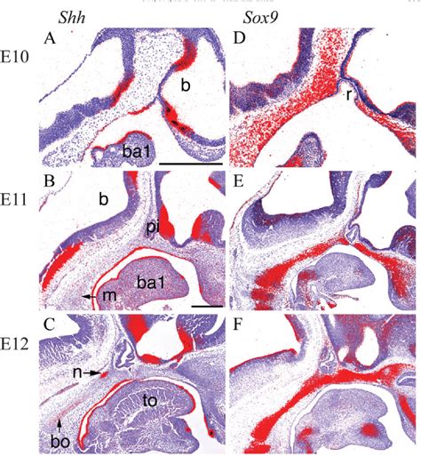 Figure 1 From Developmentally Regulated Expression Of Shh And Ihh In