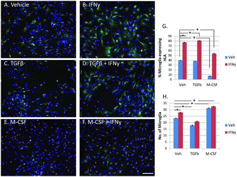 Microglial Expression Of HLA DP DQ DR Is Increased By IFNy Not