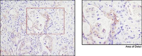 Overview Of Immunohistochemistry Ihc Cell Signaling Technology 2022