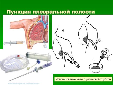 Операции на органах груди Пункция плевральной полости показания