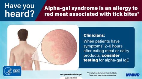 What Is Alpha Gal Syndrome Bionews