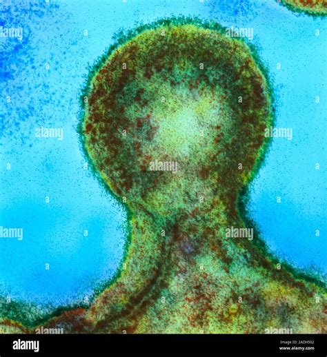 Hiv Virus Coloured Transmission Electron Micrograph Tem Of A Human