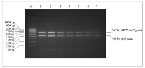 Multiplex Polymerase Chain Reaction Of Two Genes Simultaneously In A