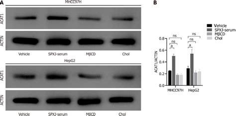 Shi Pi Xiao Ji Formula Suppresses Hepatocellular Carcinoma By Reducing