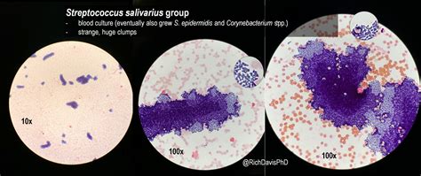 Streptococcus Salivarius Gram Stain