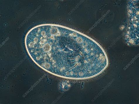 Ciliate Light Micrograph Stock Image C Science Photo Library