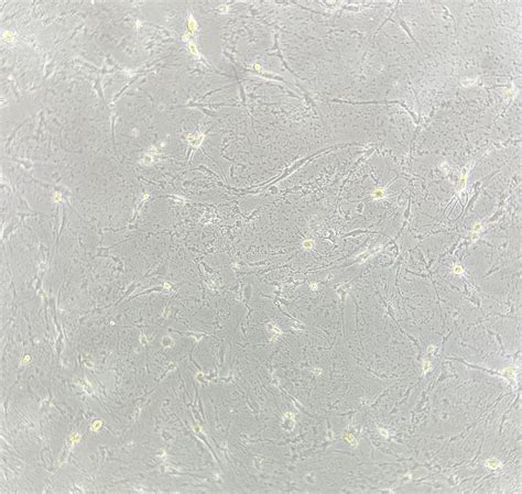 Debris Like Phenotype In Human Dermal Fibroblasts Cell Culture Any