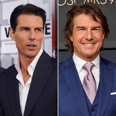Total 70 Imagen Tom Cruise Face Lift Vn