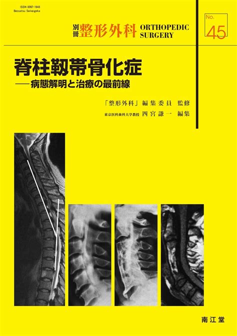 別冊 整形外科 45 脊柱靱帯骨化症 神陵文庫