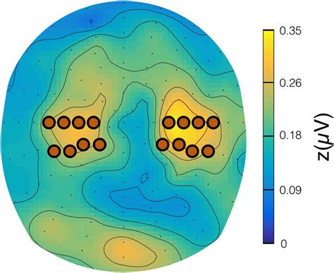 Spherical Spline Interpolated Topography Of The Grand Mean Ssvep