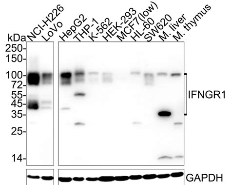 Ifngr1 Recombinant Rabbit Monoclonal Antibody [je40 50] Ha721952 Huabio