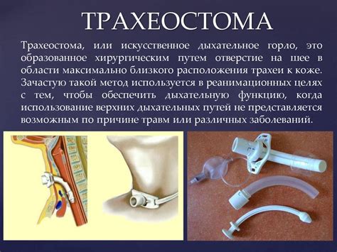 Трубка Интернет Магазин Белгород Купить Воронеж — Moi-magaz.ru