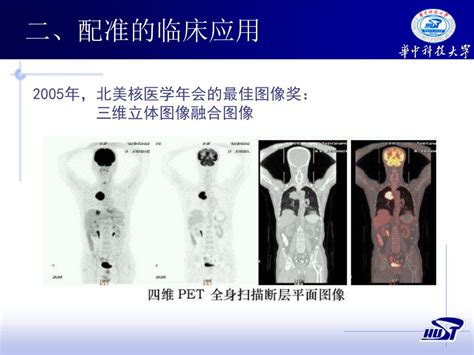 ppt 医 学 图 像 配 准 powerpoint presentation free download id 3809529