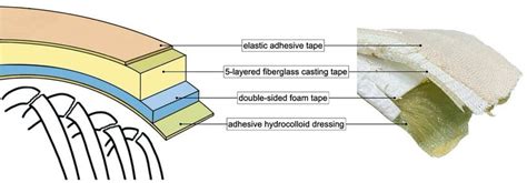 Cross Sectional View Of A K Rod The Four Layers Of The K Rod Are As