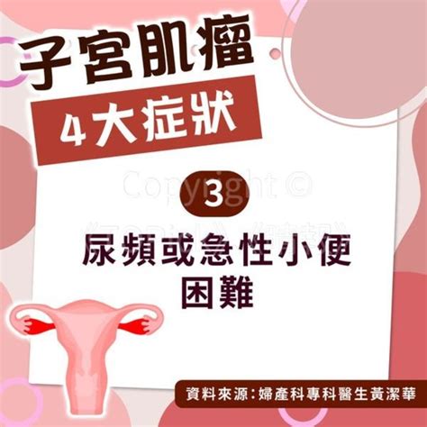 子宮肌瘤｜28歲女創業食無定時常僅睡3小時 驚揭子宮長8cm肌瘤極後悔【附子宮肌瘤4大症狀】