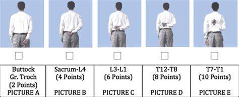 Functional Internal Rotation After Shoulder Arthroplasty A Comparison