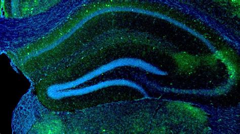 Bioengineered Protein Could Enhance Memory