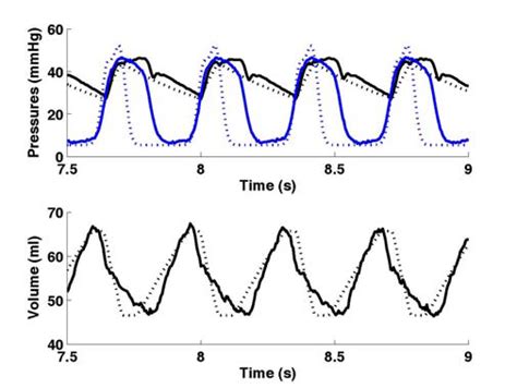 model output dotted vs clinical solid line volume and pressure