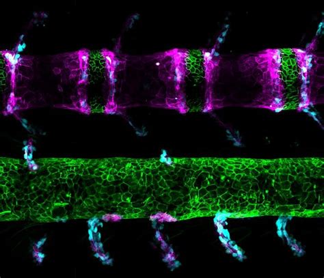Mutant Zebrafish Reveals A Turning Point In Spines Evolution