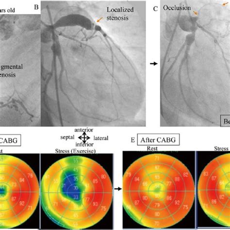Selective Coronary Angiograms And Myocardial Perfusion Imaging MPI
