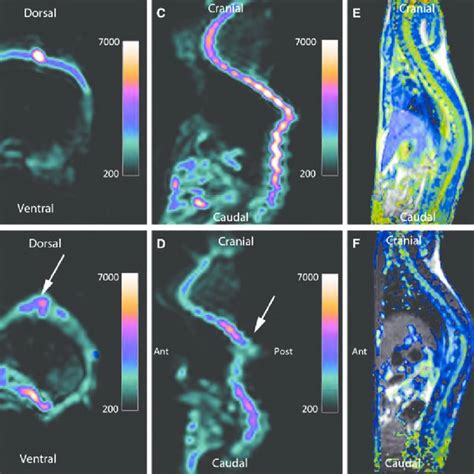 Visual Comparison Of Diffusion Tensor Imaging Dti Download