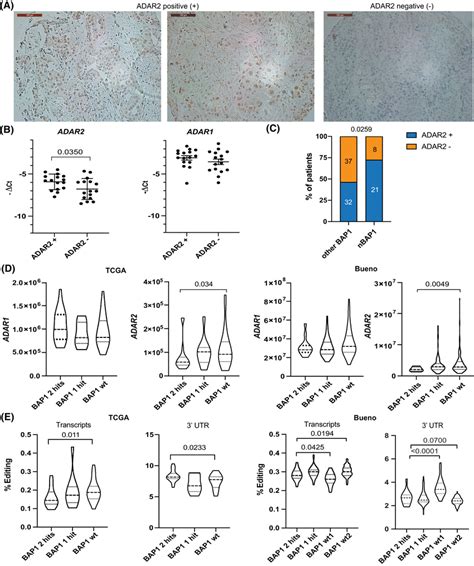 ADAR2 Expression Is Associated With Wildtype BAP1 A Representative