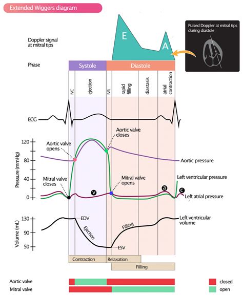 Atrial Ventricular End Diastole Wave Kick
