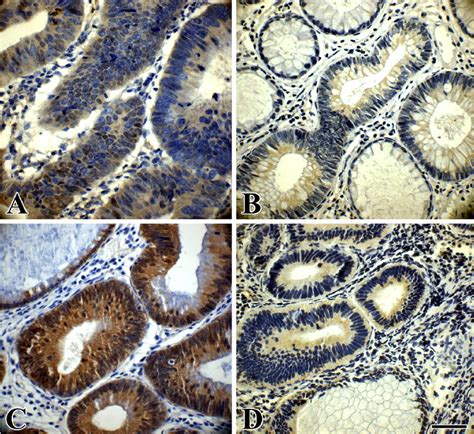 Immunohistochemical Staining Of Cyclin D1 And C Myc In An Lst And A Download Scientific
