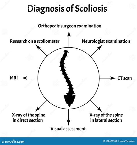 Diagnosis Of Scoliosis Spinal Curvature Kyphosis Lordosis Of The