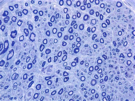 Myelinated Axon Histology