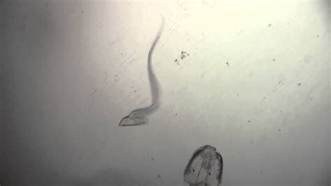 Appendicularia Youtube