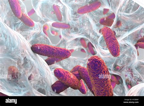 Urinary Tract Infection Bacteria Klebsiella At Christina Gonzales Blog
