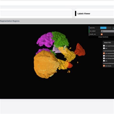 Brainchop Rendering Segmentation Output In 3d Download Scientific Diagram