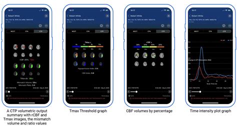viz ctp one pager viz ai knowledge base