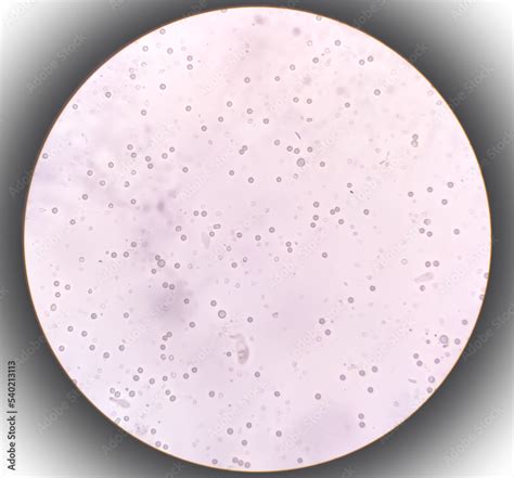 Urinalysis Under Microscope At Goldie Bridges Blog