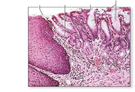 Esophageal Stomach Border Histology Diagram Quizlet Sexiz Pix The