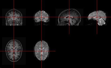 Fmri Preprocessing Using Spm 12 • Spm12r