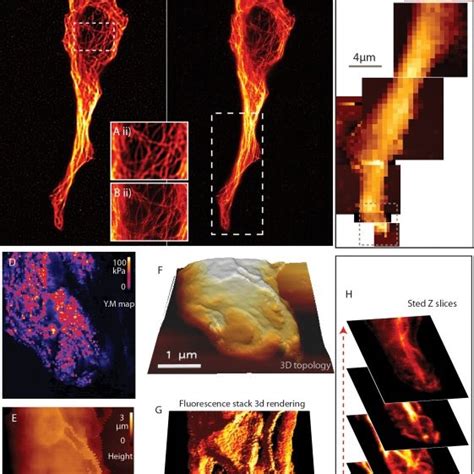 3d Sted And Confocal Imaging Sted Confocal Histogram From Microtubule
