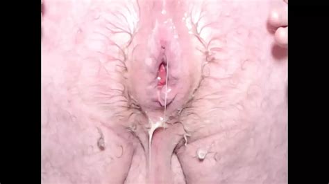 Plug Fuck Gay Gaping Gaping Porn Feat Icke1984 Xhamster