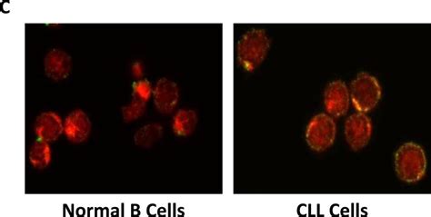 Stat3 Activated Cd36 Facilitates Fatty Acid Uptake In Chronic