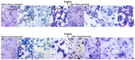 Influence Of Sex Hormones And Genetic Predisposition In Sjögrens